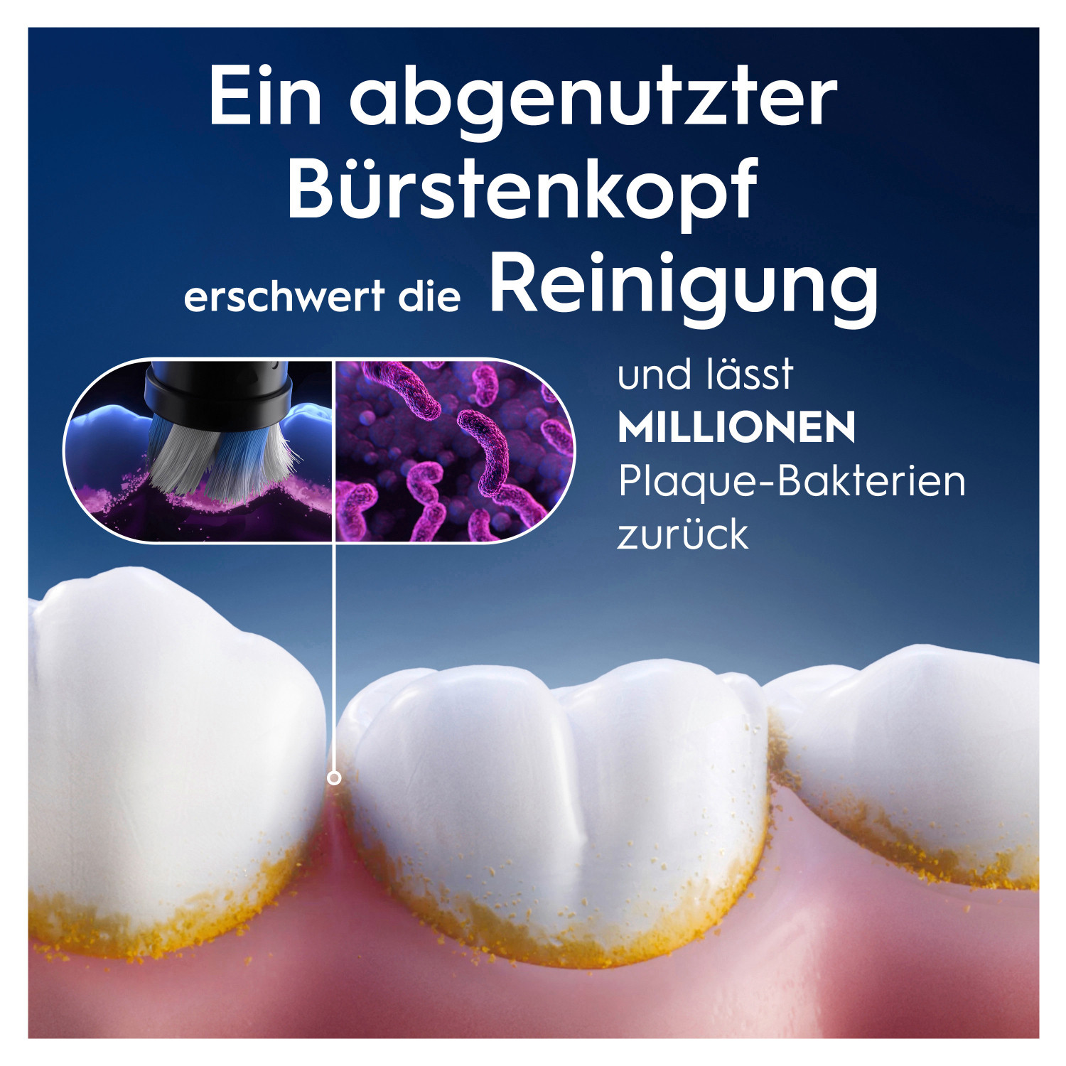 Oral-B Aufsteckbürsten iO Sanfte | electronic4you